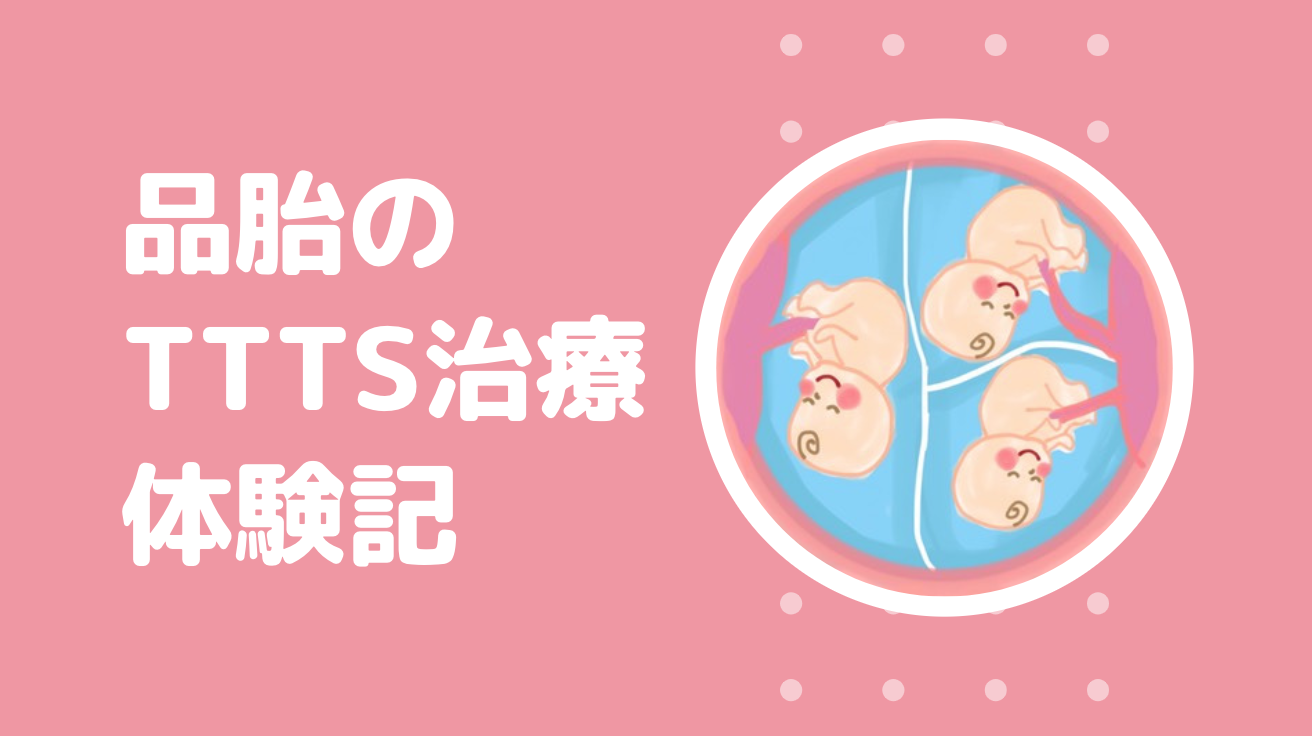 品胎でTTTS→FLPレーザー手術治療の体験記 | 多胎マム